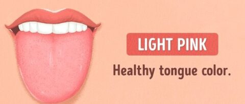 Culoarea normala a limbii-modificari de culoare si forma – Dentisis